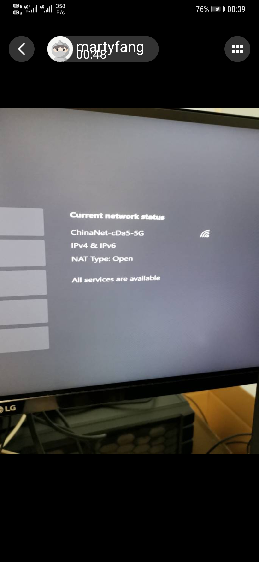 求问，我这台xsx是不是有故障 NGA玩家社区