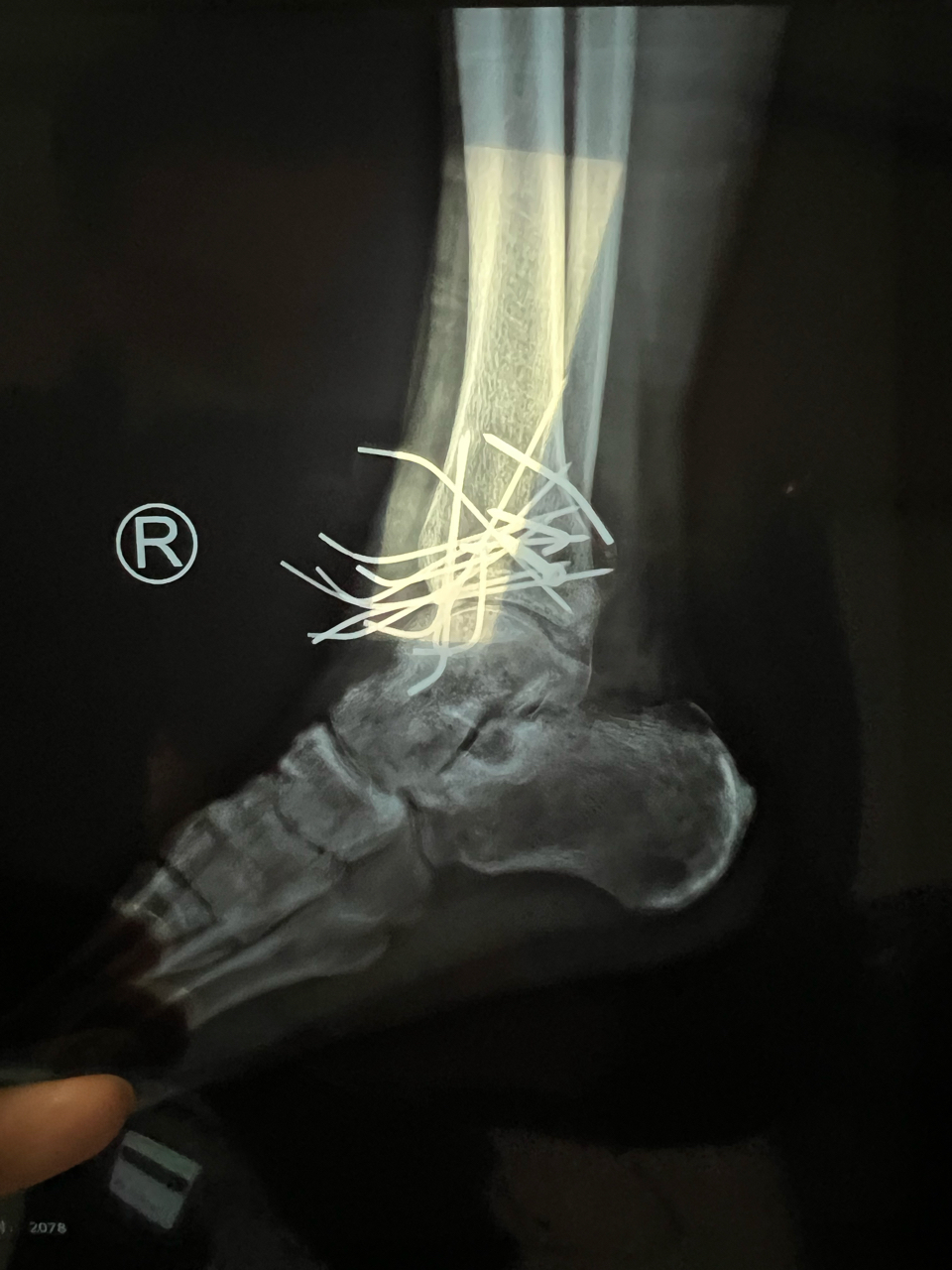 许愿看看42的jio NGA玩家社区