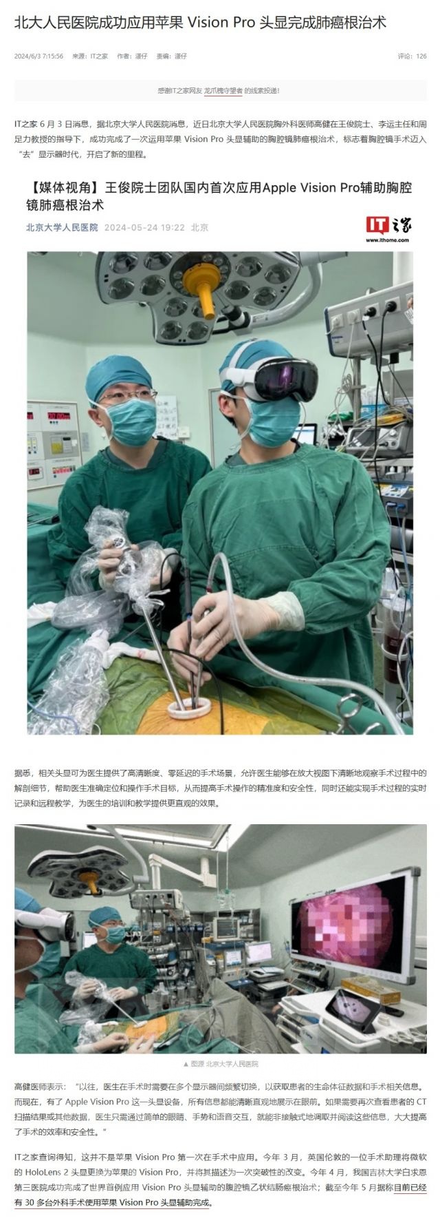 北大人民医院成功应用苹果 Vision Pro 头显完成肺癌根治术 NGA玩家社区