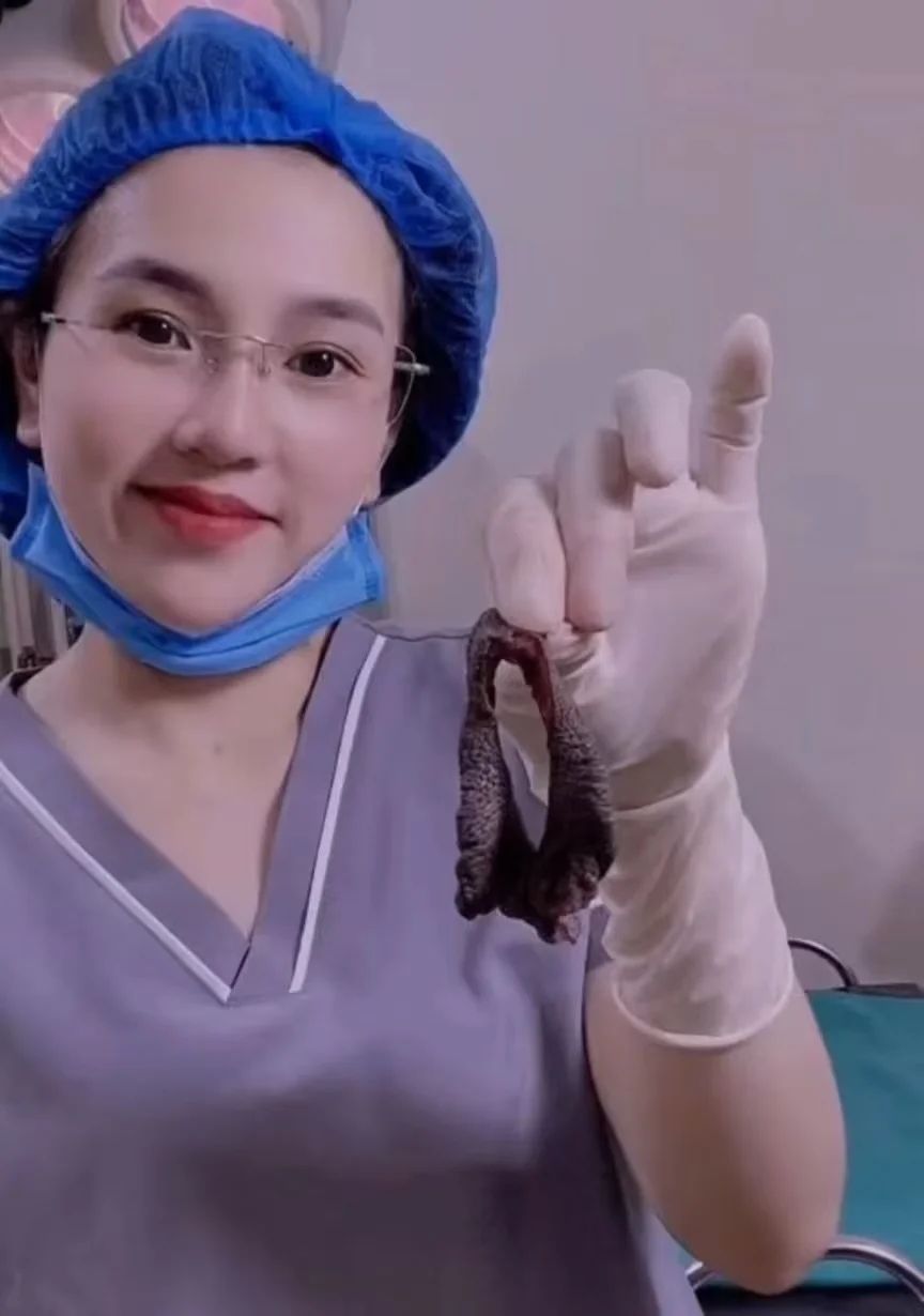 医院里全是给孩子割包皮的，老婆也要给孩子割，我坚决不同意 NGA玩家社区