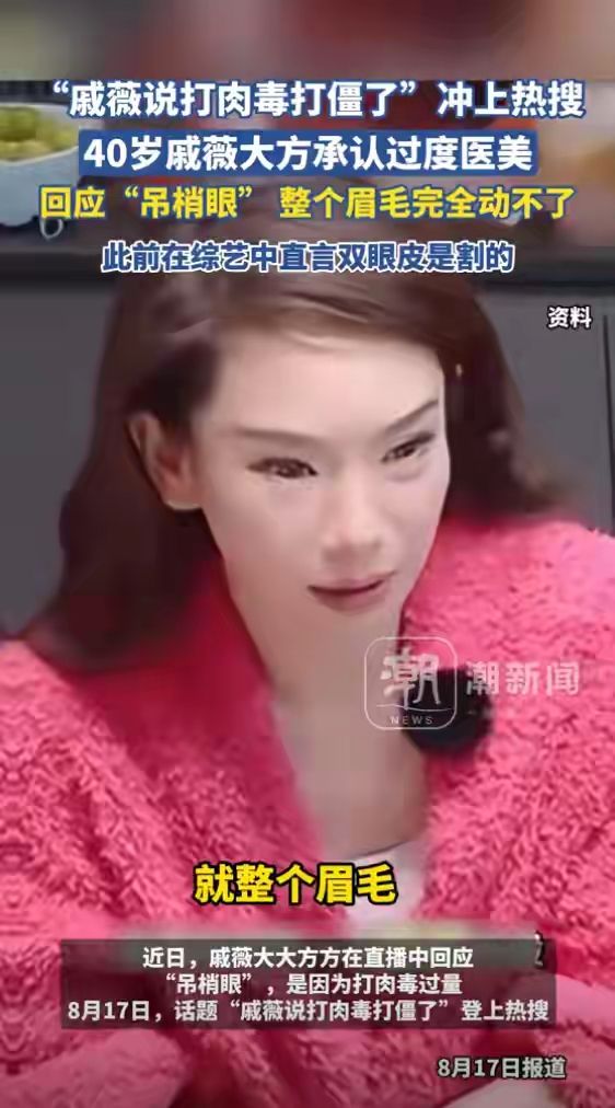 40岁戚薇大方承认过度医美，打针把脸打僵了 NGA玩家社区