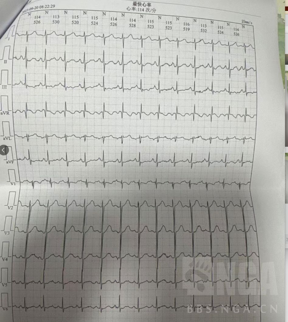 [不懂就问] 有没有学医大佬来解惑一下(心血管科)顺带吐槽下现在的医生(个例不AOE) NGA玩家社区